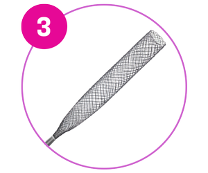 Product — Pounce™ Thrombectomy System