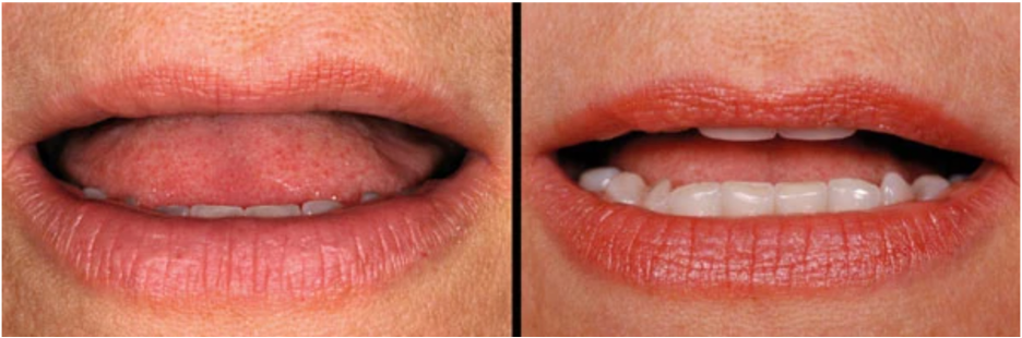 Smile Esthetics — LAT Dentistry