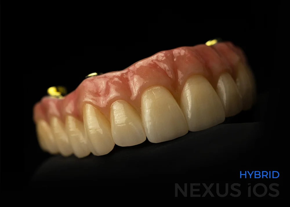 See our range of precision milled prosthesis finished in aesthetic ...