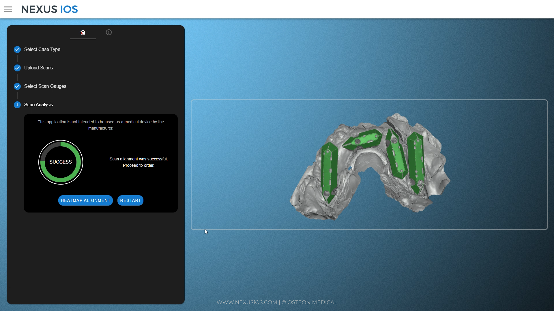 Using Your Intraoral Scanner with Nexus iOS — Nexus iOS