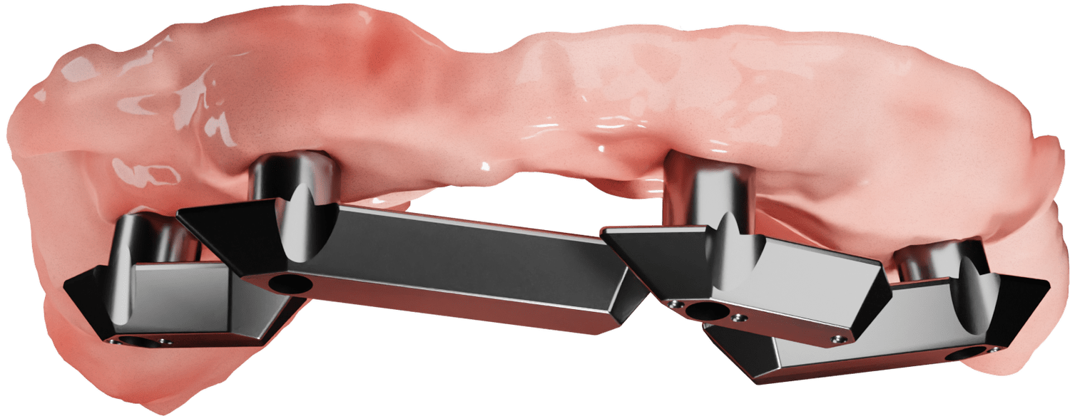Nexus iOS Immediate Full-Arch Dental Prosthetics — Nexus iOS