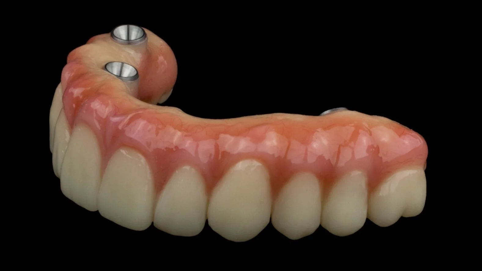 Nexus iOS Immediate Full-Arch Dental Prosthetics — Nexus iOS