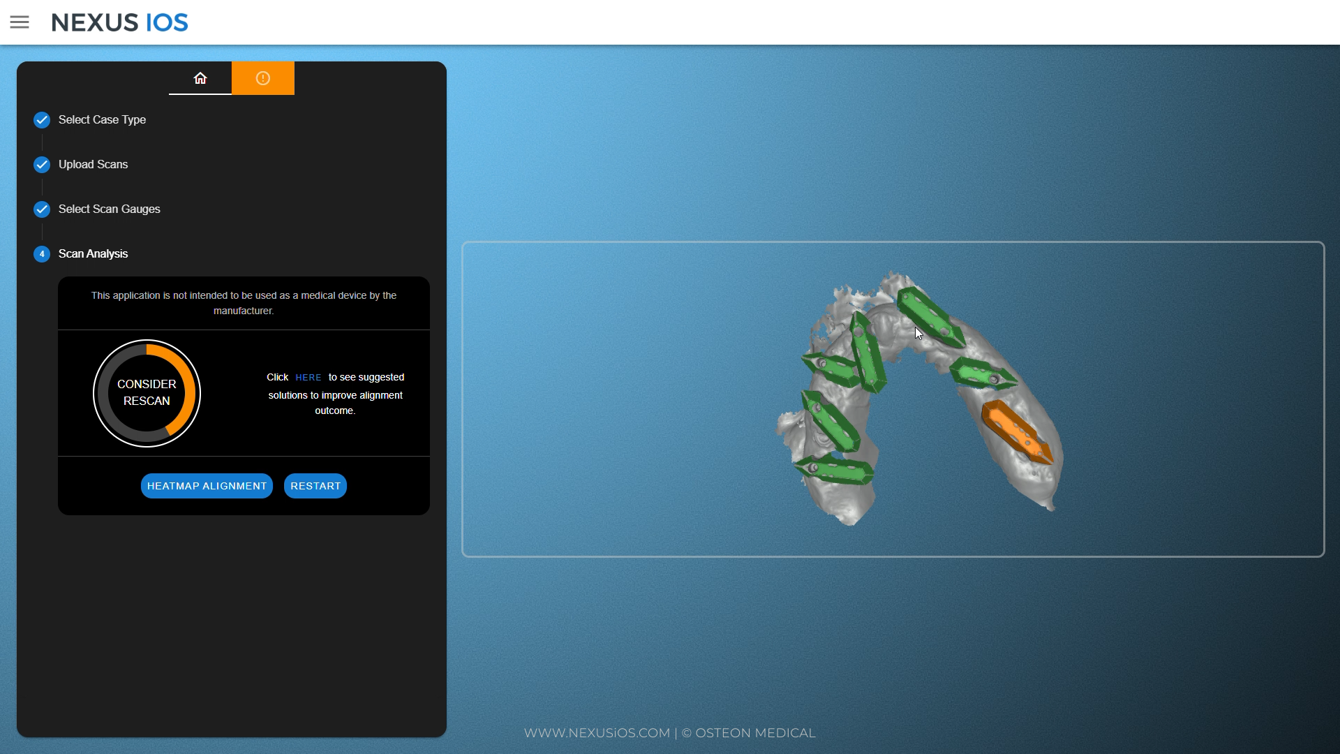 Using Your Intraoral Scanner with Nexus iOS — Nexus iOS