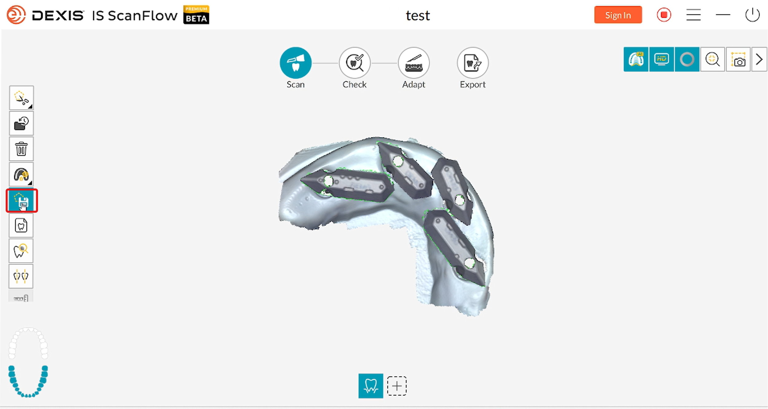 Using Your Intraoral Scanner with Nexus iOS — Nexus iOS