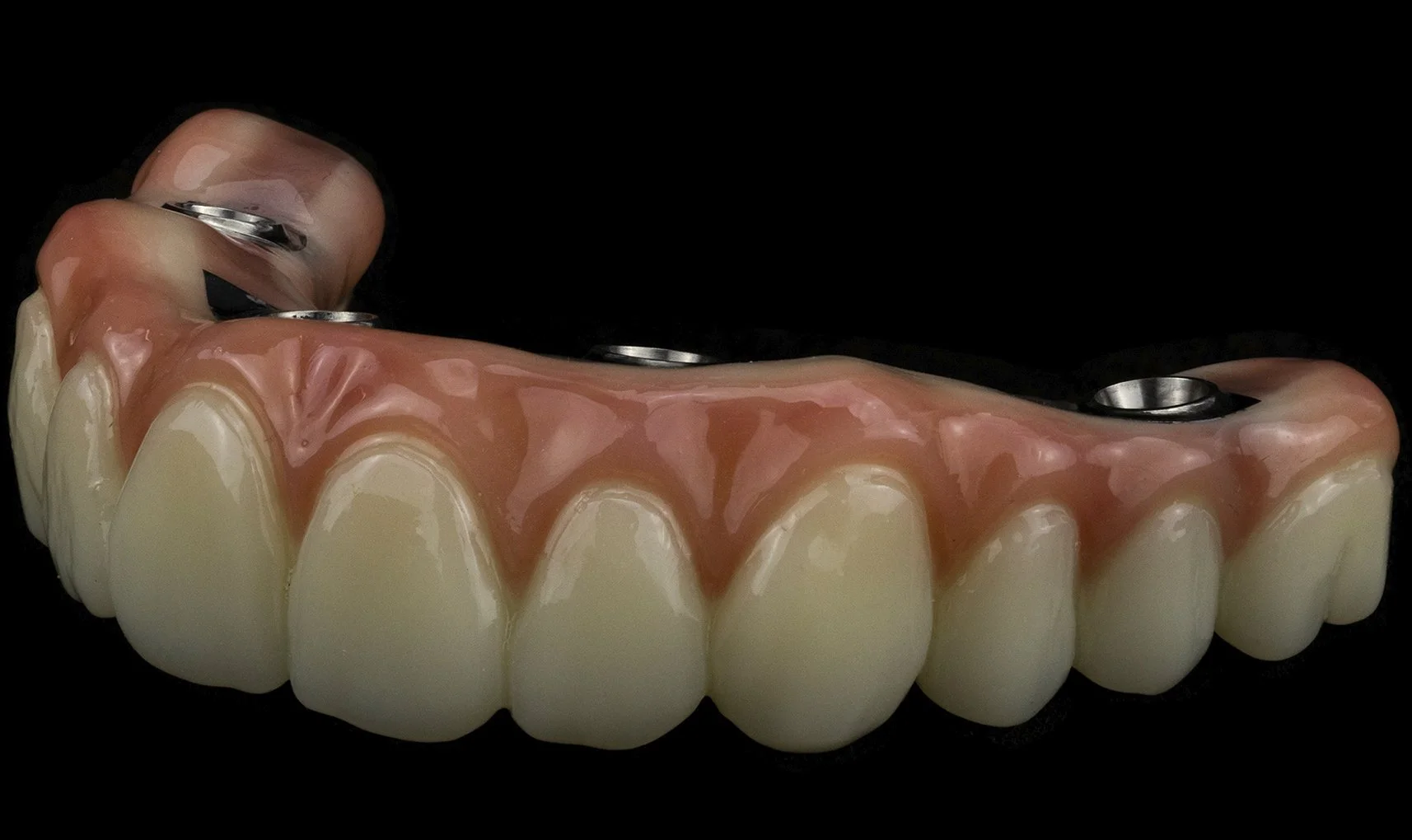Nexus iOS Immediate Full-Arch Dental Prosthetics — Nexus iOS