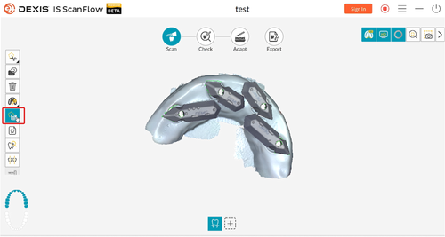 Using Your Intraoral Scanner with Nexus iOS — Nexus iOS