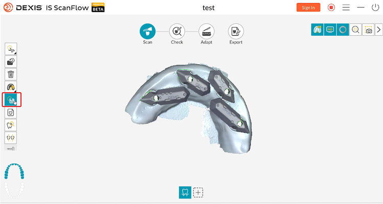 Using Your Intraoral Scanner with Nexus iOS — Nexus iOS