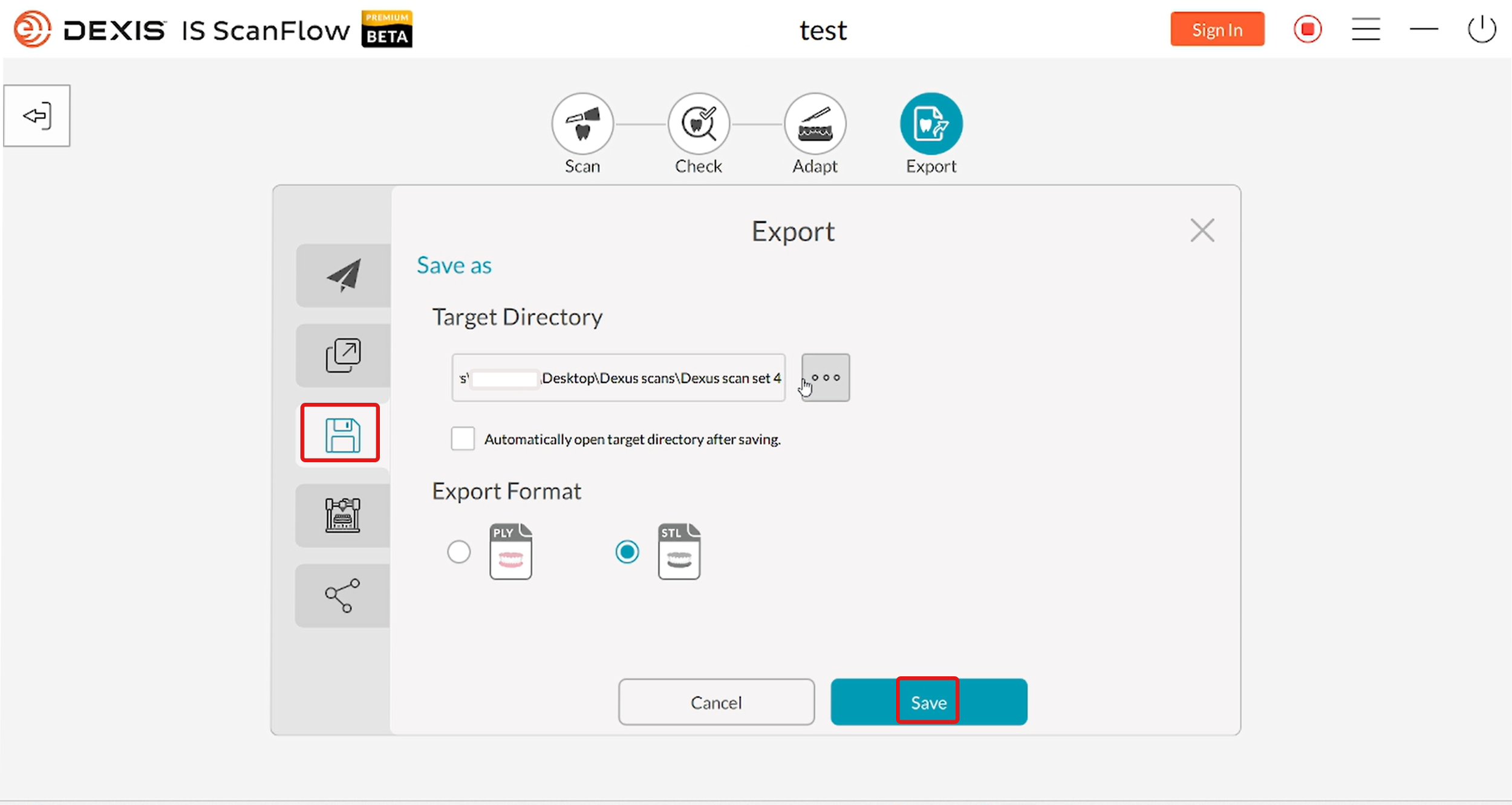 Using Your Intraoral Scanner with Nexus iOS — Nexus iOS