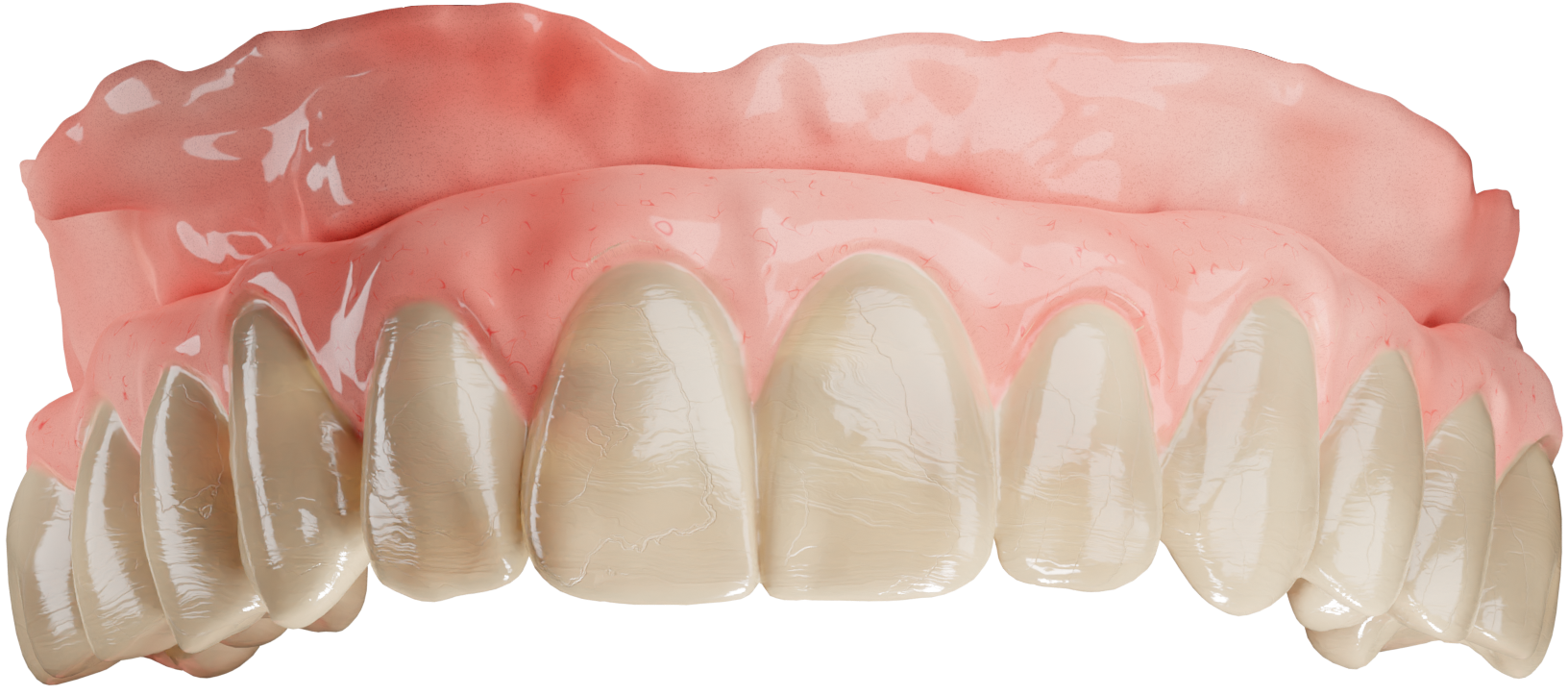 Nexus iOS Immediate Full-Arch Dental Prosthetics — Nexus iOS