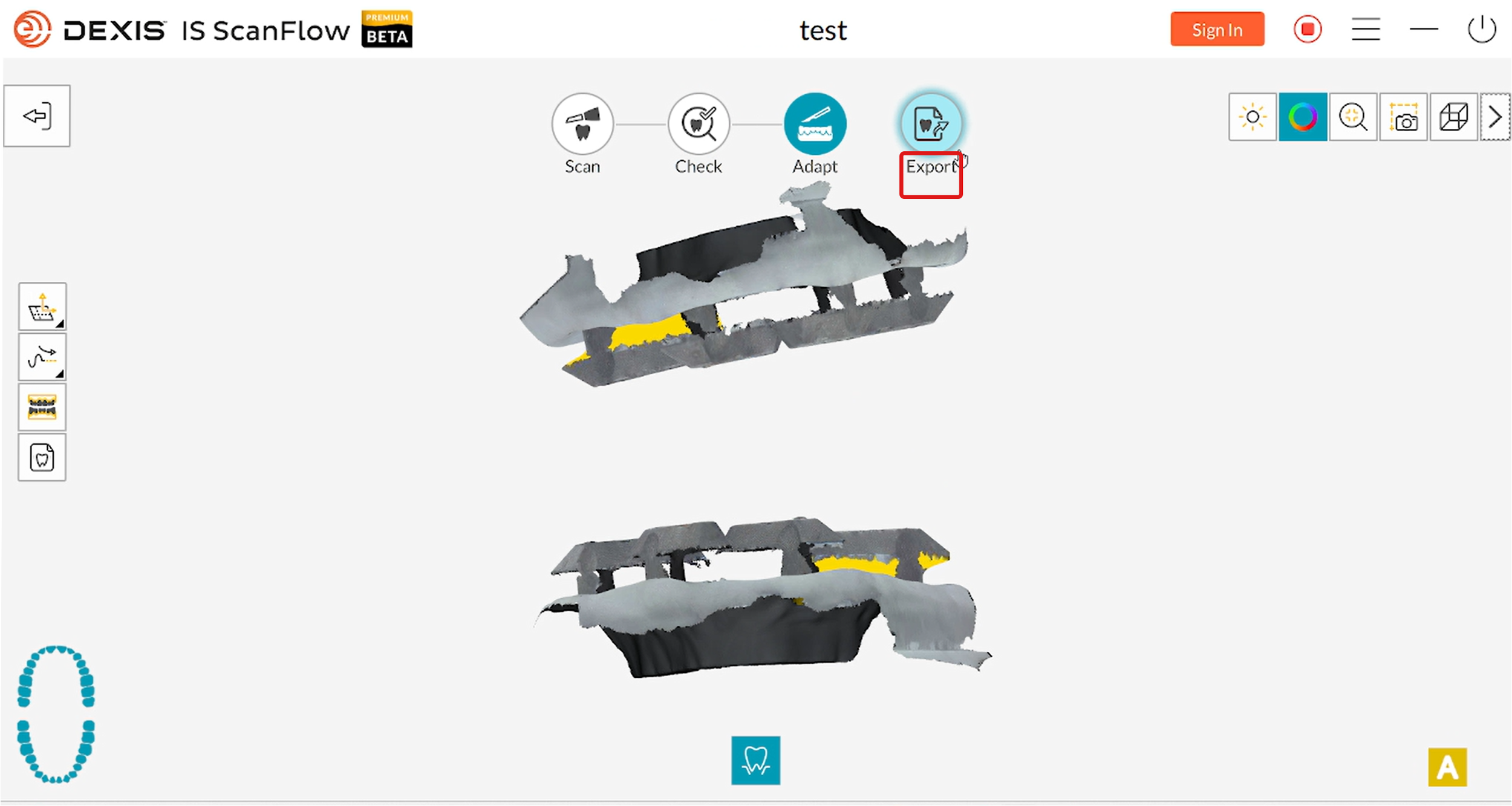 Using Your Intraoral Scanner with Nexus iOS — Nexus iOS