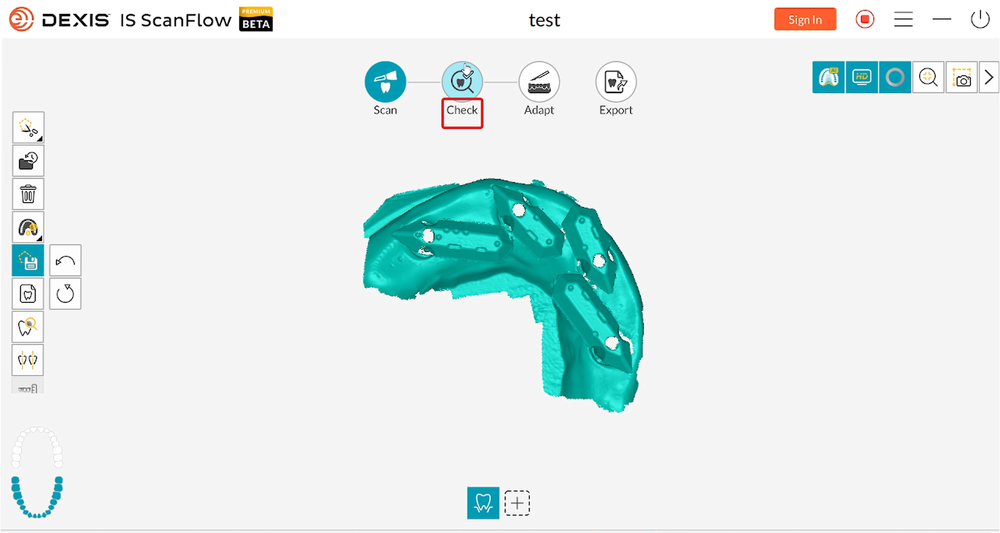 Using Your Intraoral Scanner with Nexus iOS — Nexus iOS
