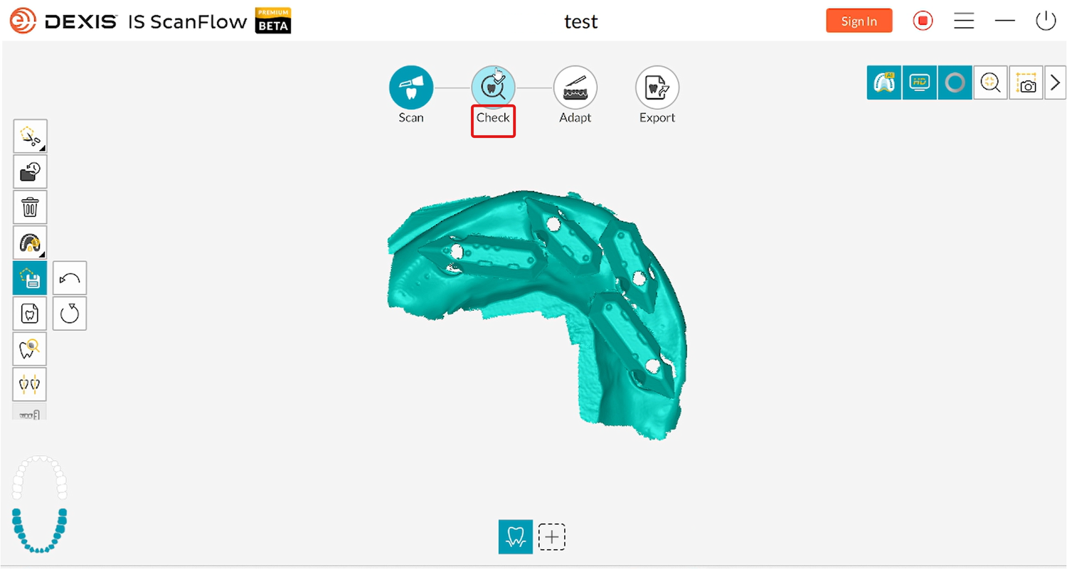 Using Your Intraoral Scanner with Nexus iOS — Nexus iOS