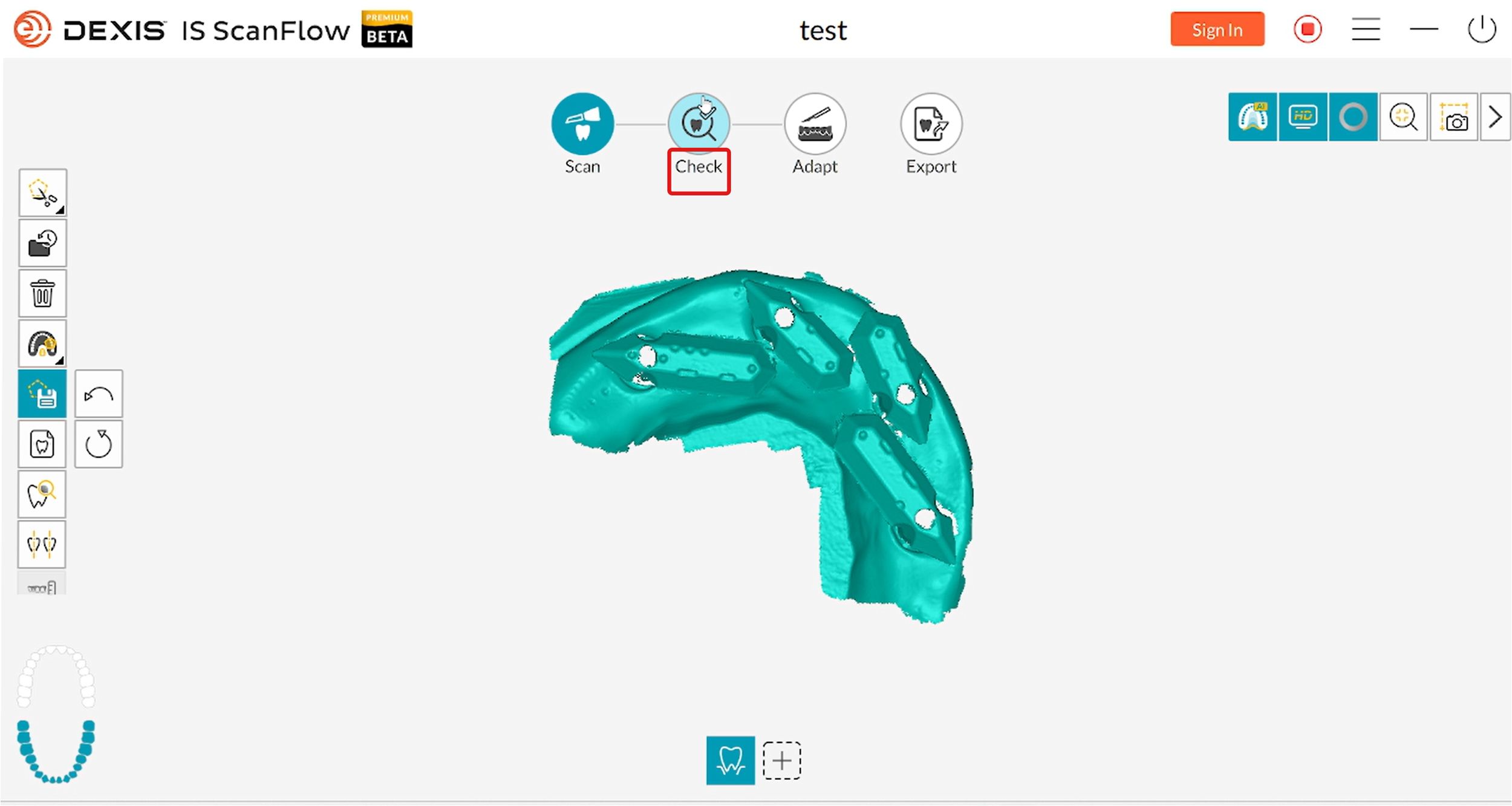 Using Your Intraoral Scanner with Nexus iOS — Nexus iOS