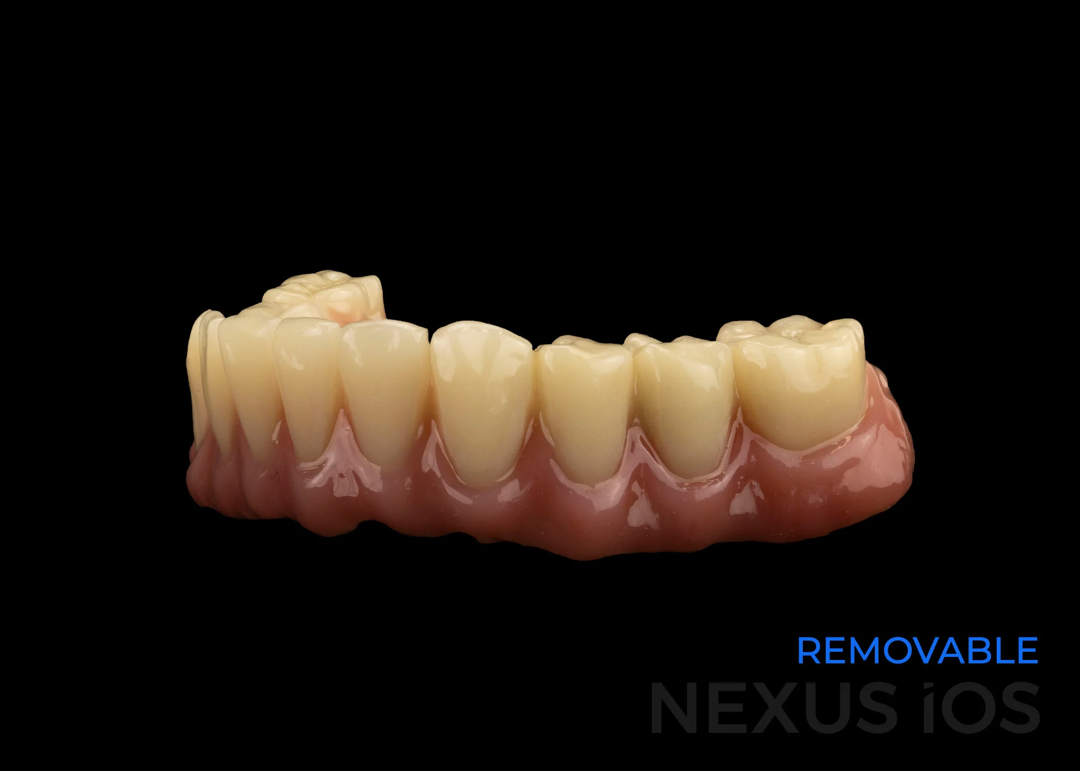 Nexus Removable — Nexus iOS