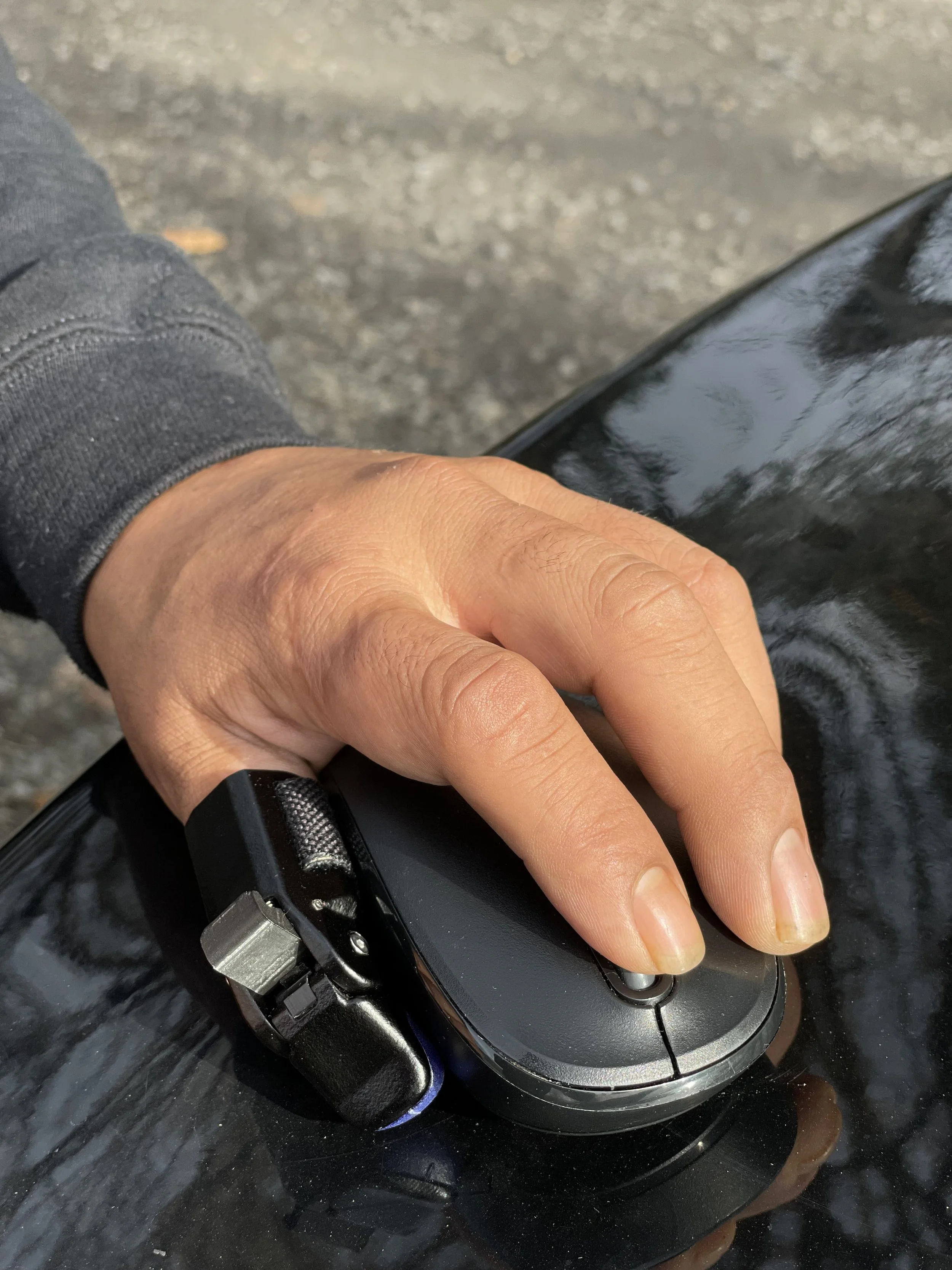 Thumb Prosthesis — Probionica