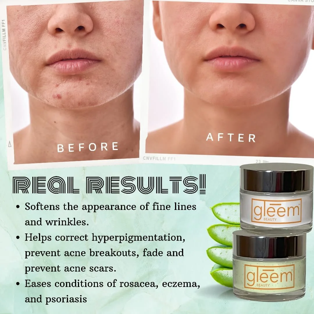 Gleem Beauty™ - Organic Aloe Vera Skincare Products