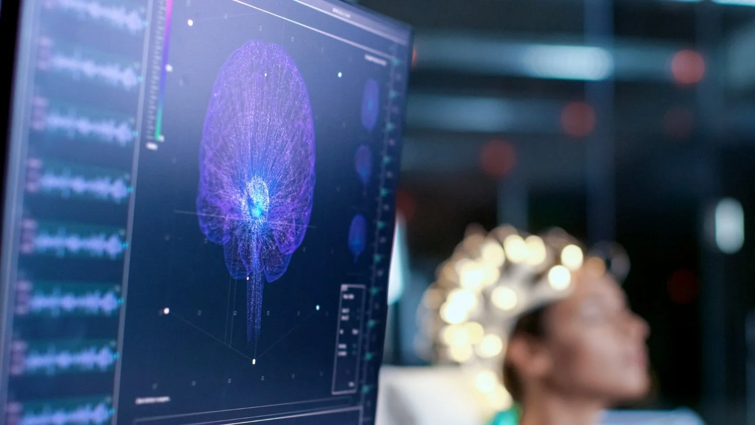 NAPS Consortium for REM Sleep Behavior Disorder