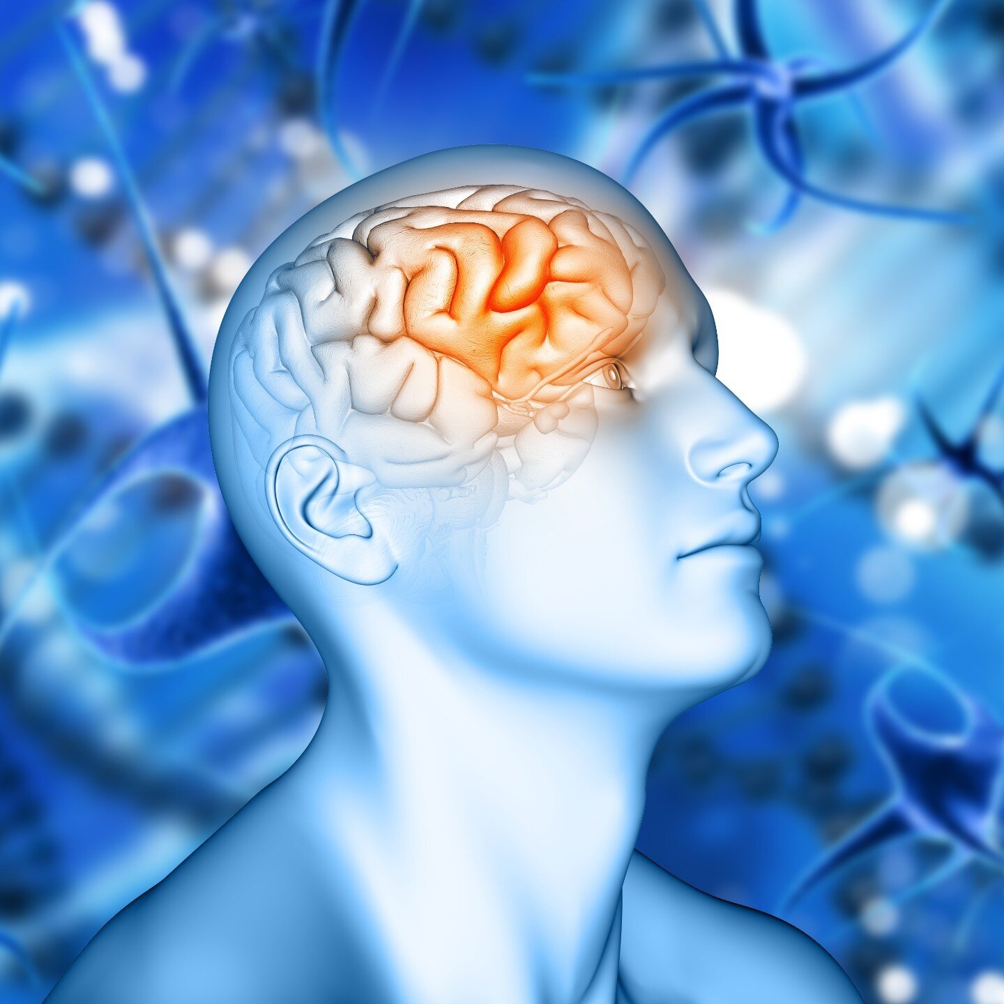 NAPS Consortium for REM Sleep Behavior Disorder