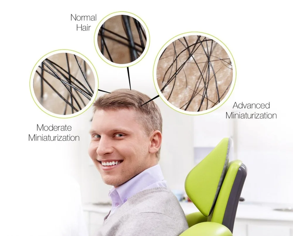 Male Hair Loss: Causes, Solutions & What You Need to Know