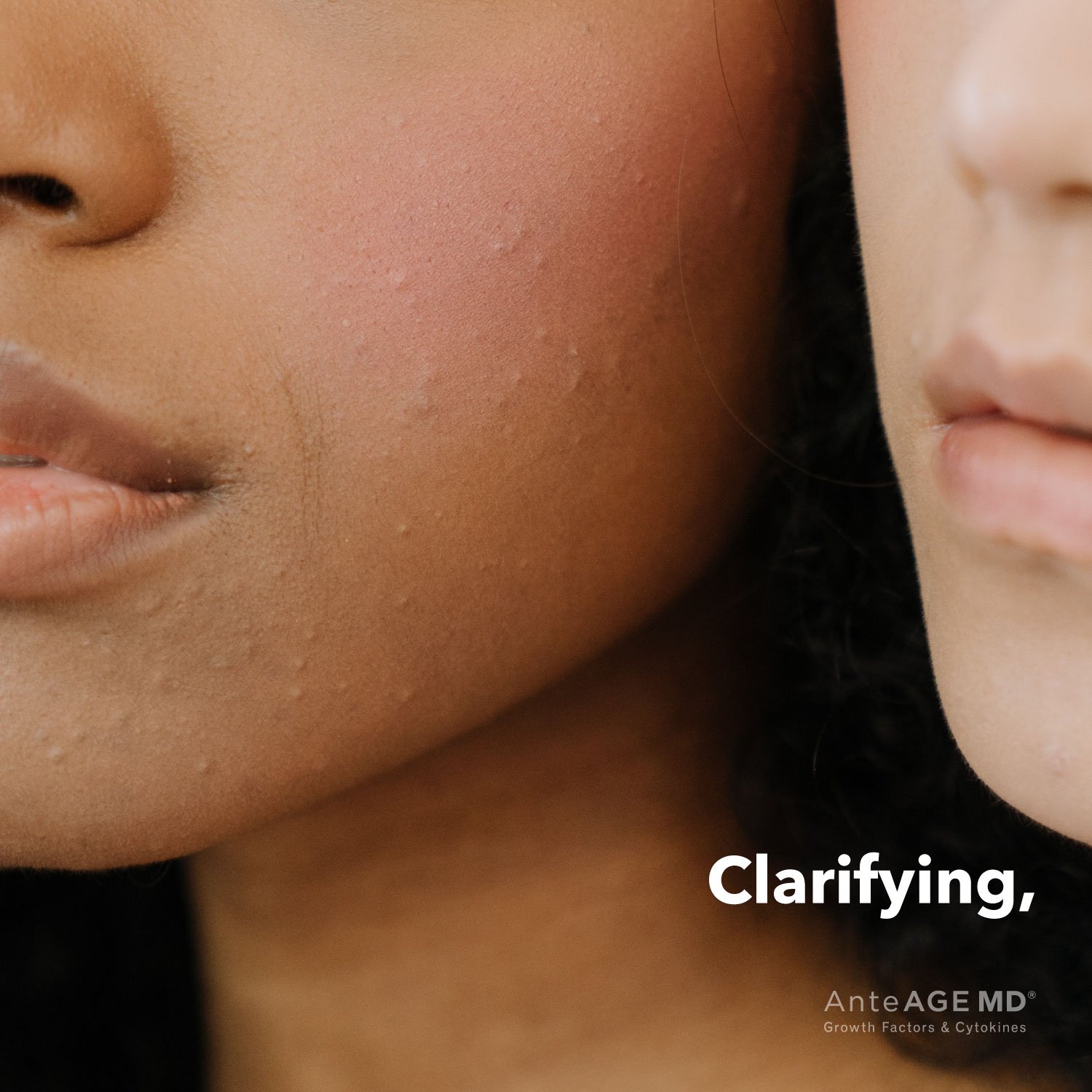 Laser Obsession Beauty Spa