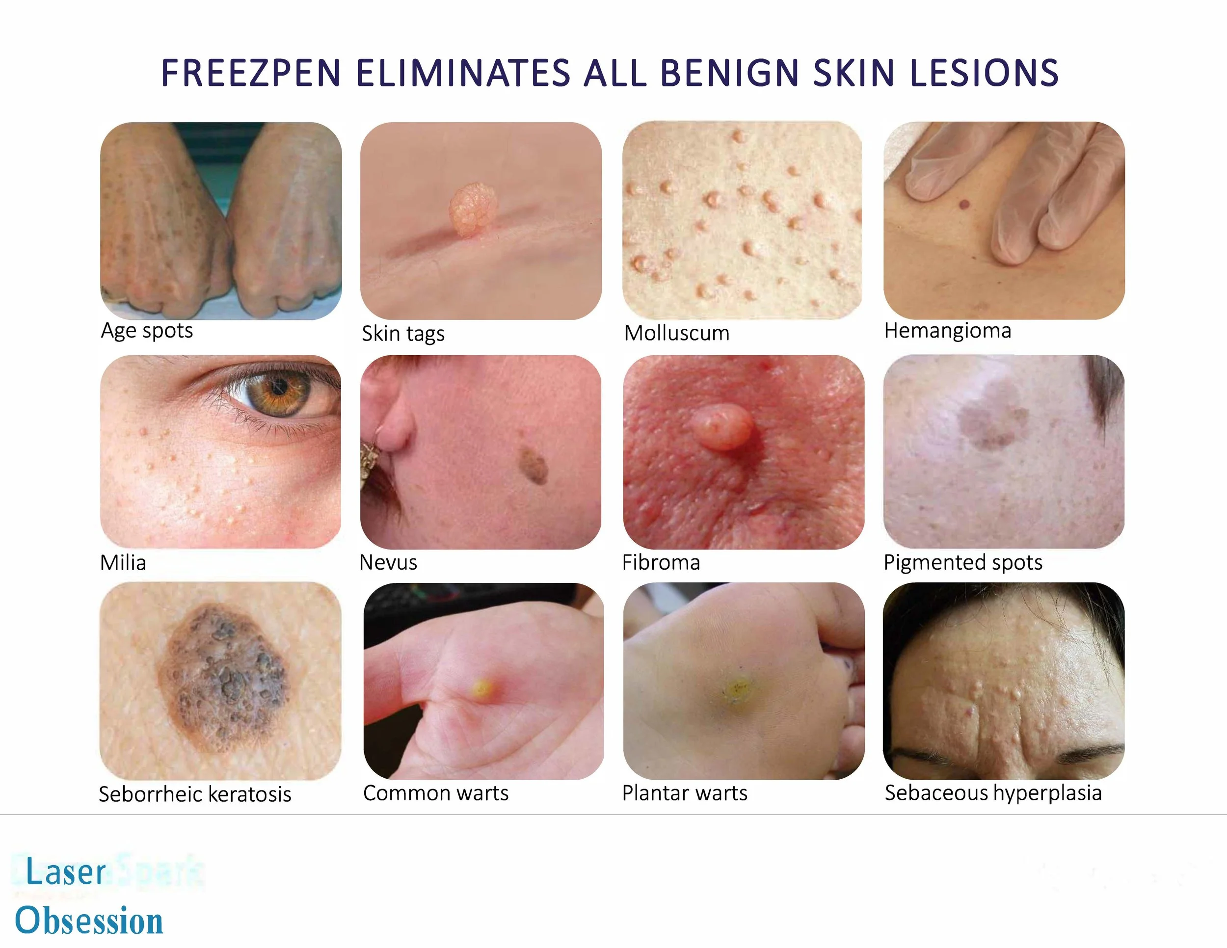 Products — Laser Obsession Beauty Spa