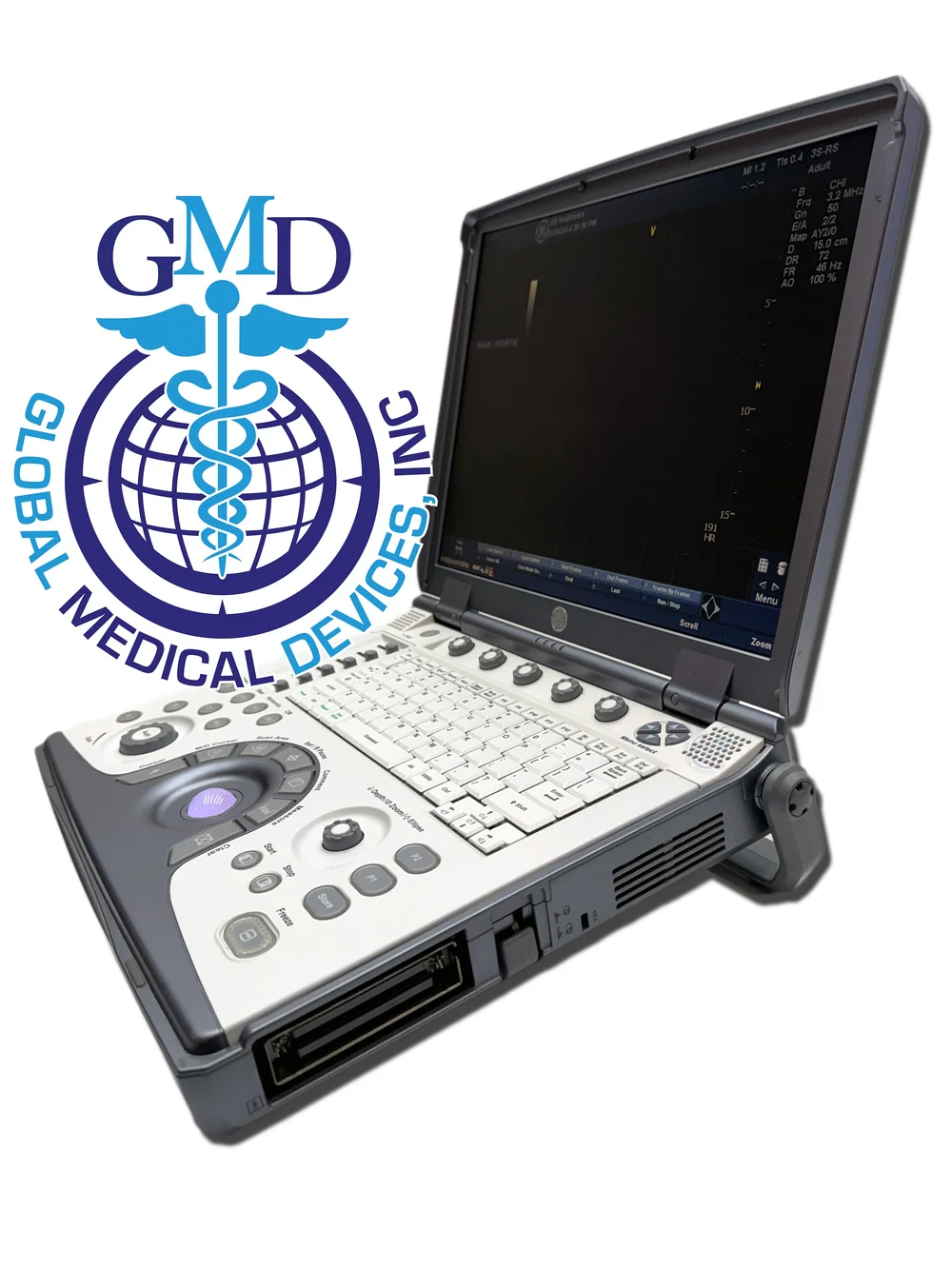 GE Vivid E95 Ultrasound — GlobalMedicalDevices