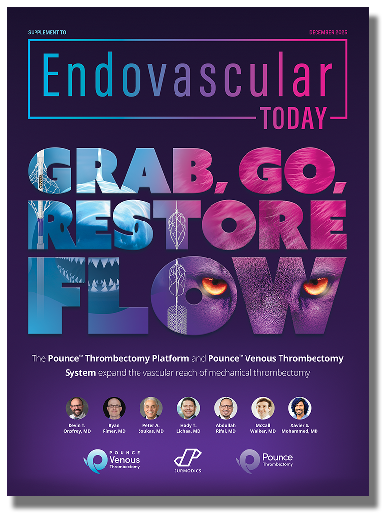 Pounce™ Thrombectomy System