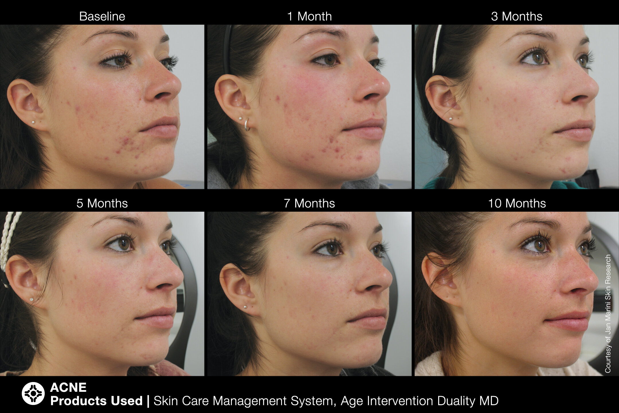 Facial Treatments — Flawless