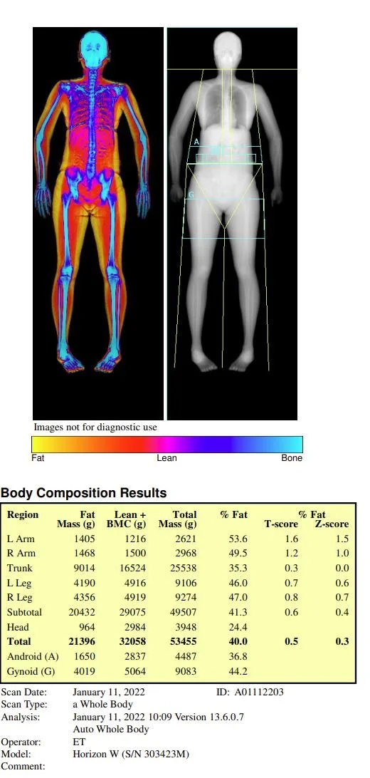 Lean Body Mass Longevity Lifespan Society