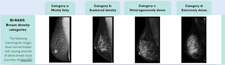 Breast density and you! — Inner West Women's Health | Sexual and ...