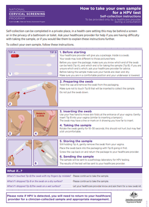A positive step in cervical cancer screening: a self-collected option ...