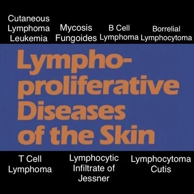 Borrelial Lymphocytoma
