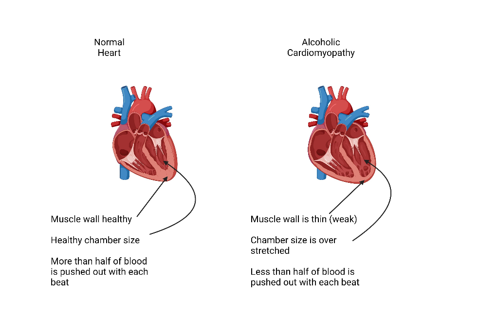General 3 — AcePre LLC