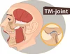 Dry Needling for TMJ — Morningside Acupuncture NYC