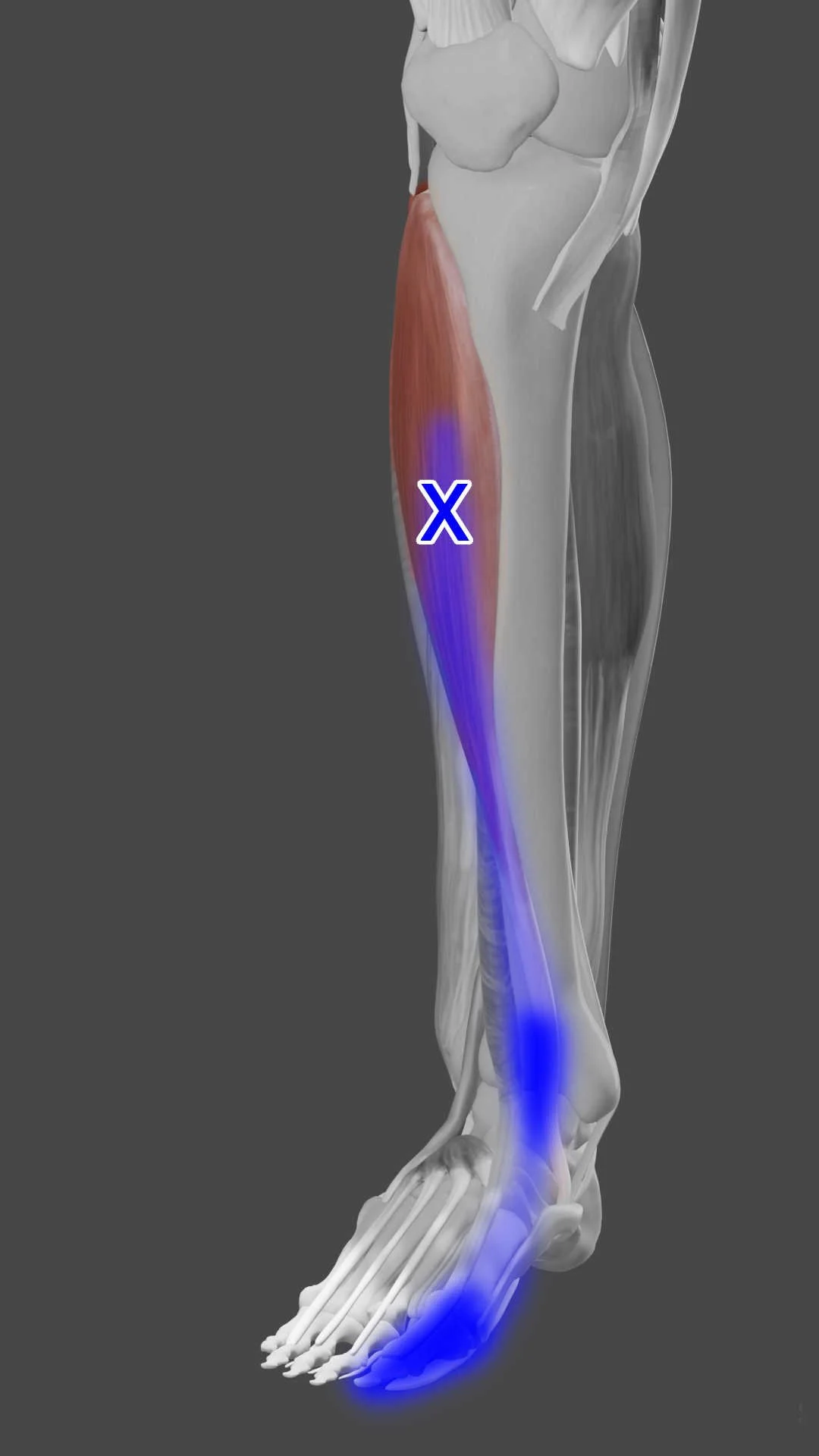 Tibialis Anterior Trigger Points — Morningside Acupuncture NYC