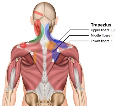 Trigger Point Dry Needling NYC — Morningside Acupuncture NYC
