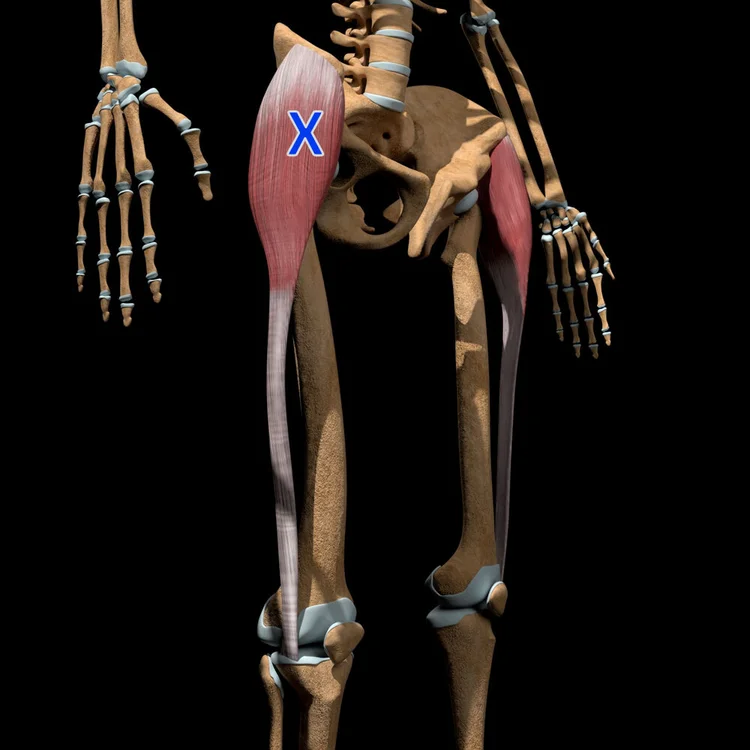 Tensor Fasciae Latae (TFL) Trigger Points — Morningside Acupuncture NYC