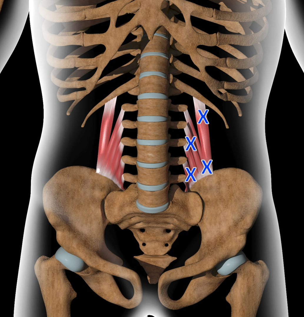 Quadratus Lumborum Selbst Behandeln – PJLM