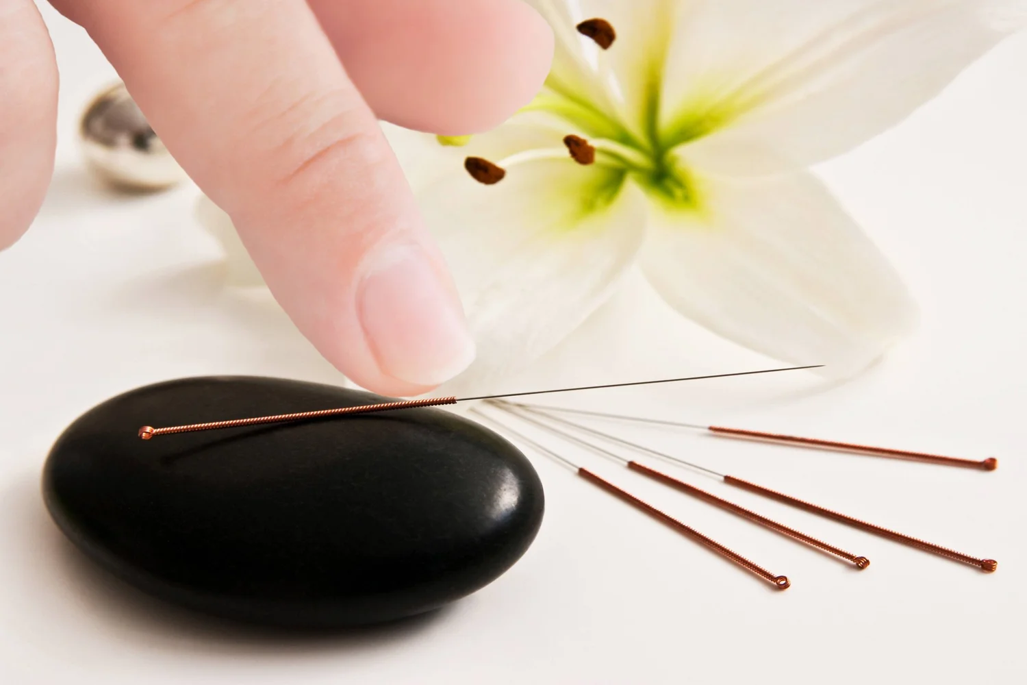 A History of Acupuncture in the US — Morningside Acupuncture NYC