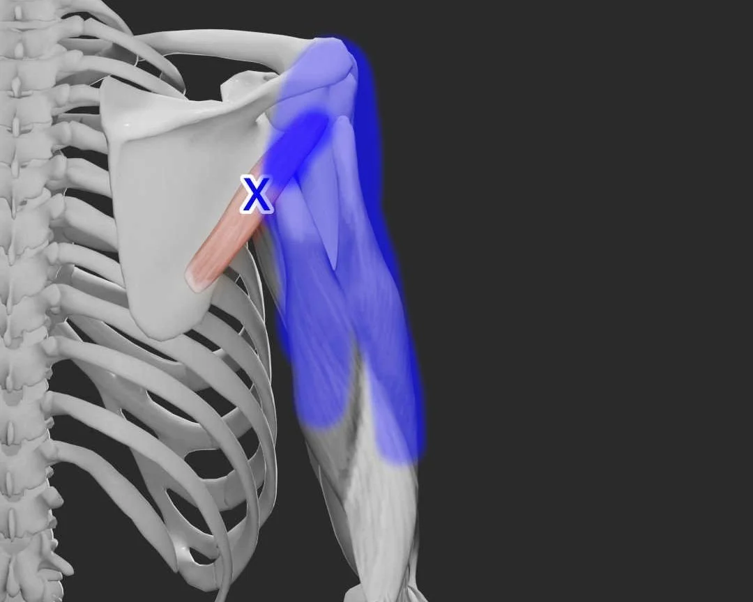 Teres Minor Trigger Points — Morningside Acupuncture NYC