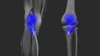 Popliteus Trigger Points — Morningside Acupuncture NYC