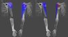 Acupuncture for Deltoid Pain — Morningside Acupuncture NYC