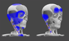 Sternocleidomastoid (SCM) Trigger Points — Morningside Acupuncture NYC