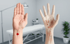 PC6 Acupuncture Point — Morningside Acupuncture NYC