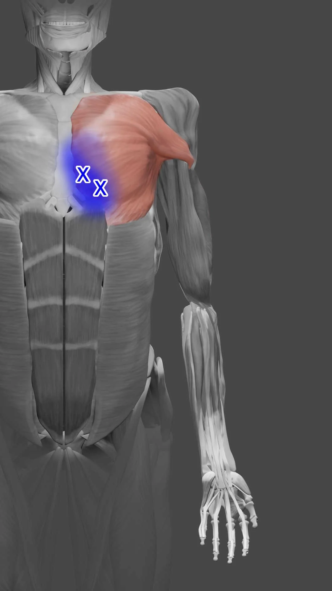 Treating Pectoralis Major Muscle Pain — Morningside Acupuncture NYC