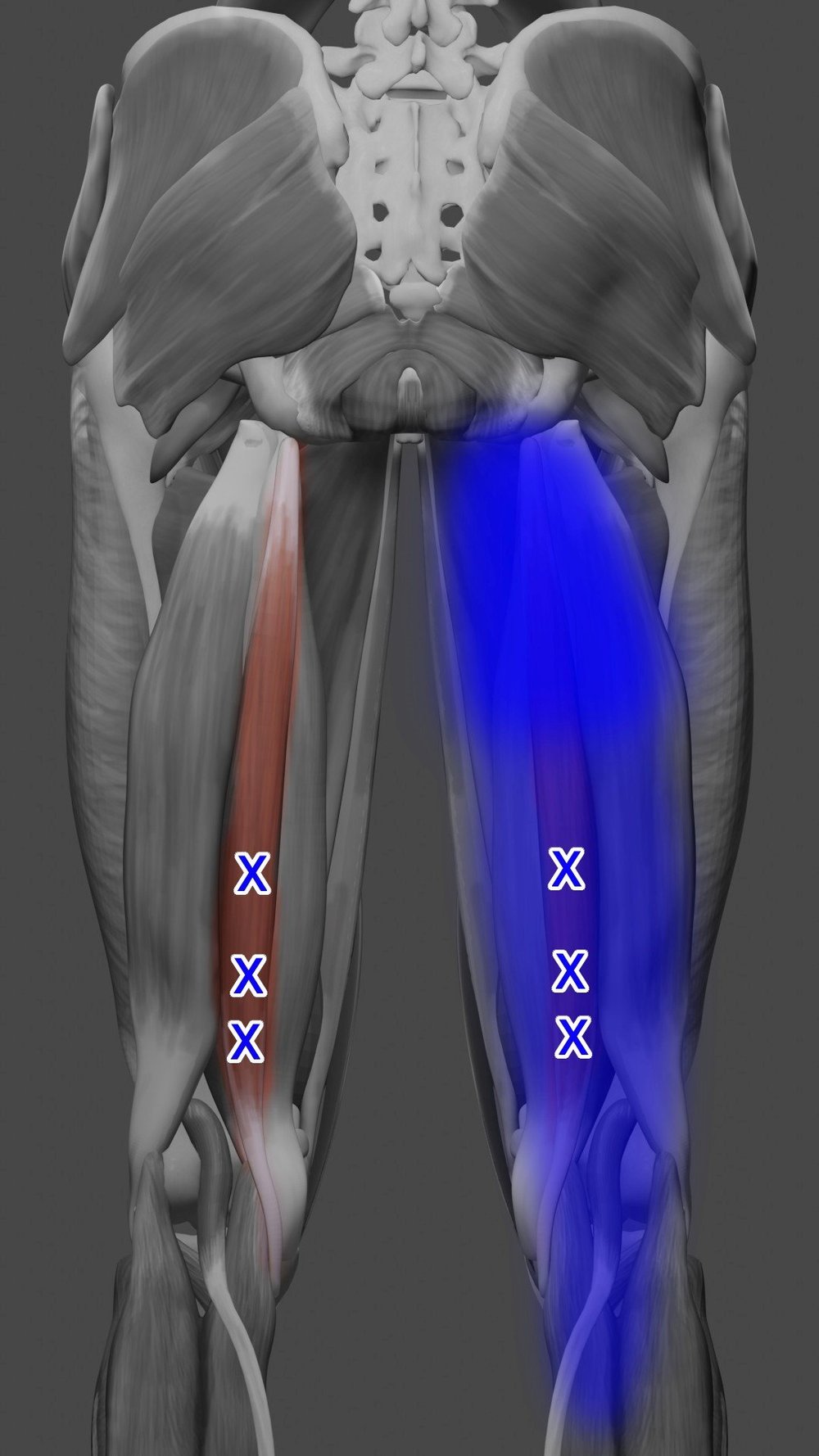 Acupuncture for Semitendinosus Muscle Pain — Morningside Acupuncture NYC