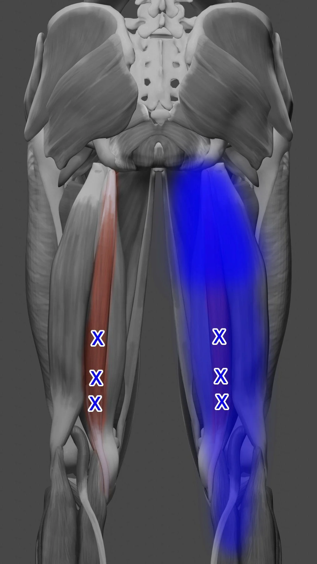 Acupuncture for Semitendinosus Muscle Pain — Morningside Acupuncture NYC