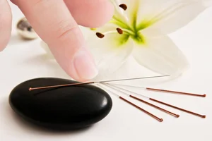 The Ultimate List of Acupuncture Styles and Techniques: Which One is ...