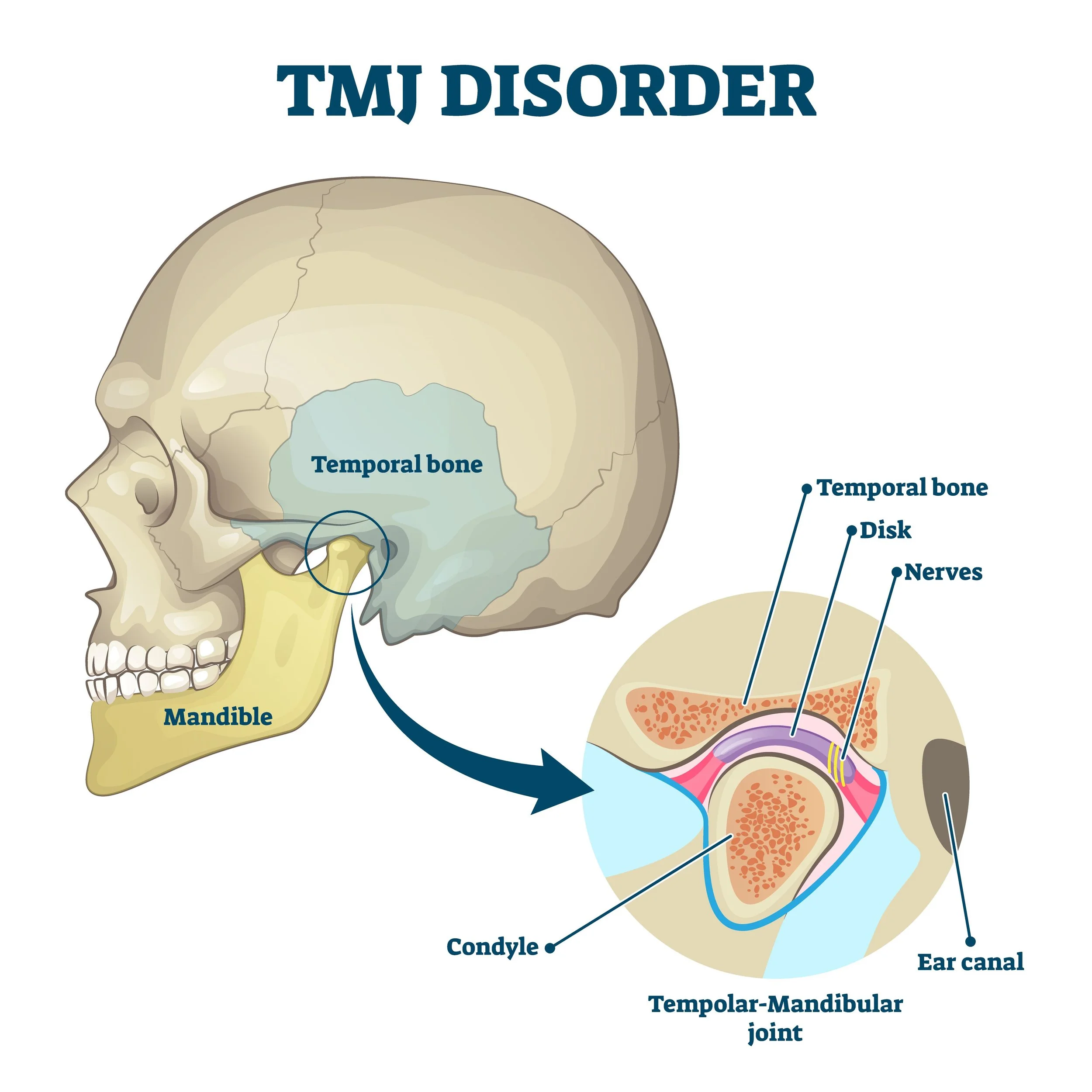 Dry Needling for TMJ — Morningside Acupuncture NYC