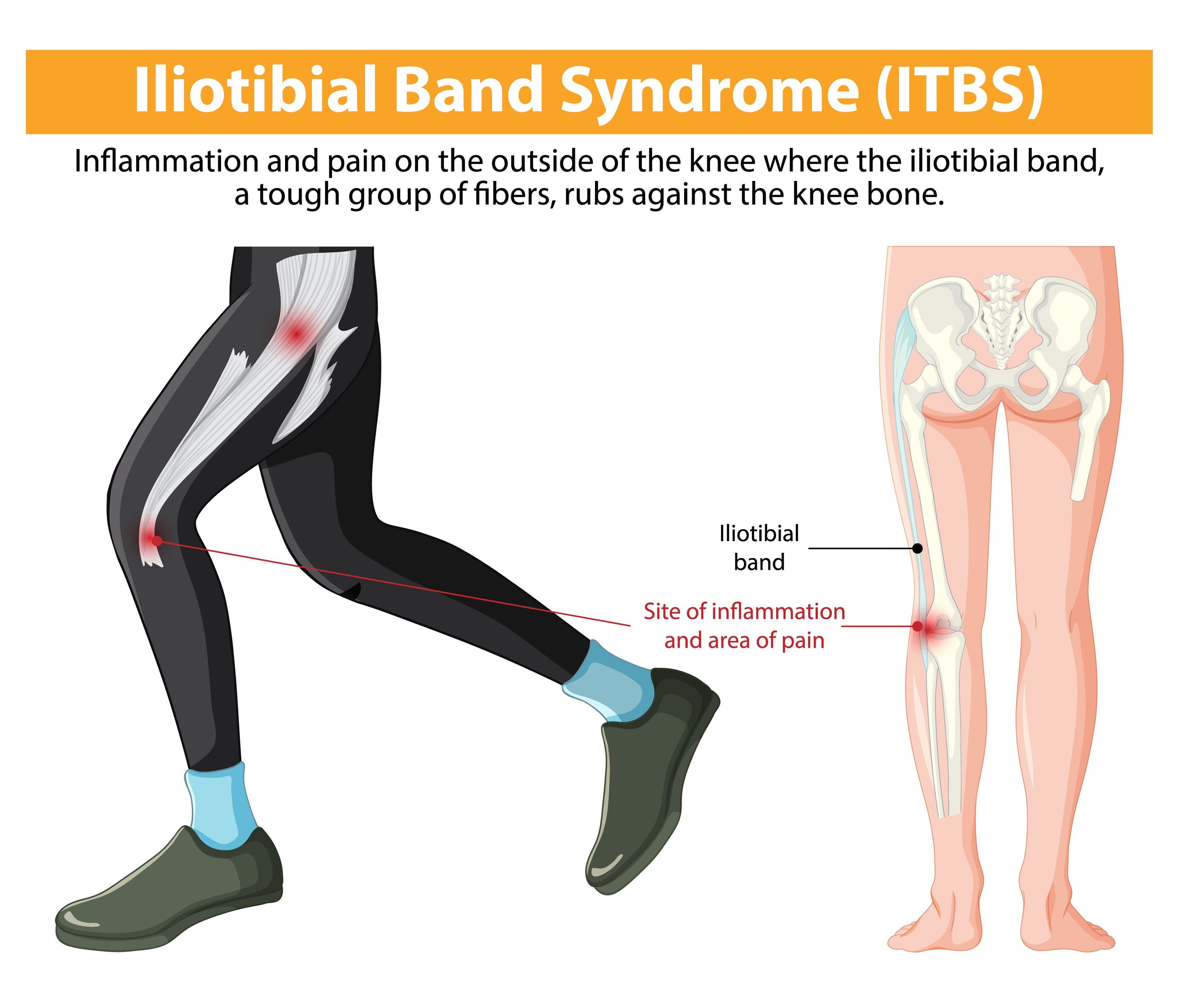 IT Band Syndrome Treatment NYC — Morningside Acupuncture NYC